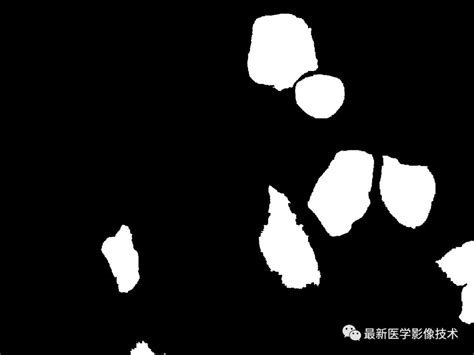 医学图像处理案例（三）——用分水岭算法分割重叠细胞 腾讯云开发者社区 腾讯云