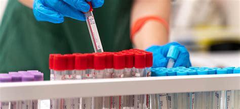 Metabolic Assessement Test Meridian Integrative Wellness