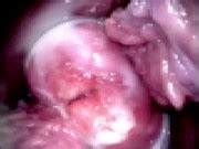 Cuzco S View Of The Cervix And Vaginal Wall Xxx Mobile Porno Videos