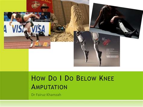 How To Perform A Below Knee Amputation Ppt