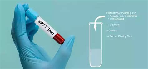 A Guide To Aptt Test