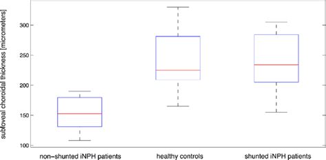 Distribution Of Subfoveal Choroidal Thickness For Shunted Patients Download Scientific