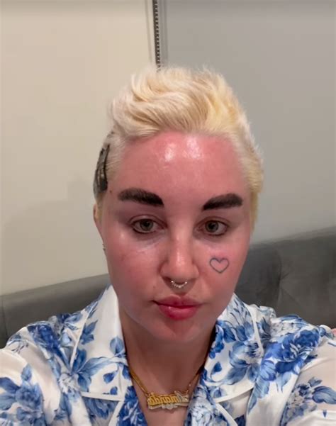 Amanda Bynes Steps Out In La With New Bold Two Toned Hair
