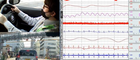 Research Projects At Sdu Health Informatics And Technology