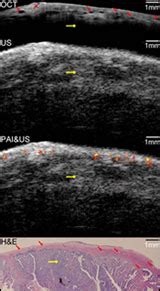 Hybrid Imager Spots Elusive Cancer Research Technology Sep 2011 BioPhotonics