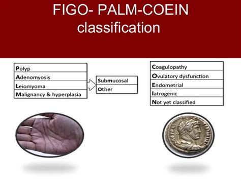 Palm Coein A Comprehensive Approach To Diagnosing Abnormal Uterine Bleeding