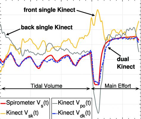 Comparing Fvc A And Svc B Volume Time Curves Of Dual Kinect V Dk