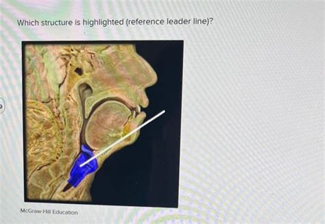 Solved Which Structure Is Highlighted Reference Leader
