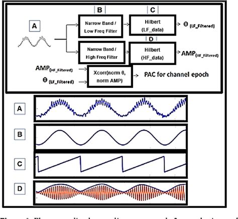 Figure 2 From Phase Amplitude Coupling Localizes Pathologic Brain With