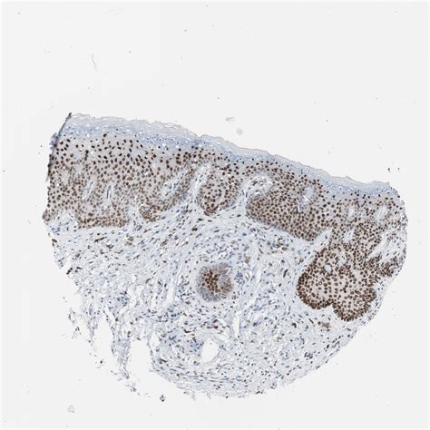 Tissue Expression Of Cebpb Staining In Skin The Human Protein Atlas