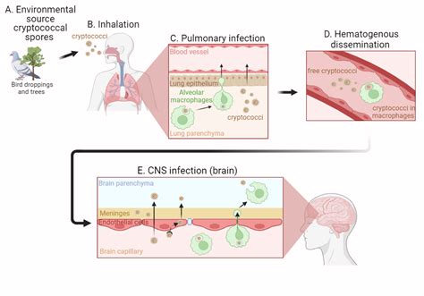 Pathogenesis Of Cryptococcus Infection From Inhalation To Cns