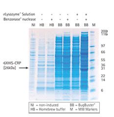 Bacterial Cell Lysis Buffer Recipe Bryont Blog
