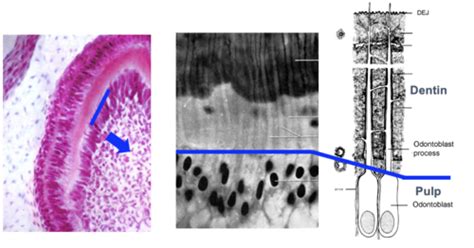 Dentin Flashcards Quizlet