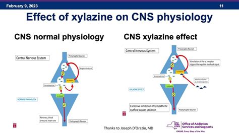 Learning Thursdays Xylazine Youtube
