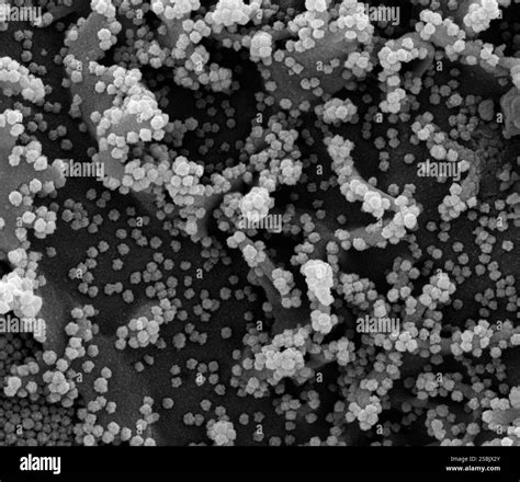 Scanning Electron Micrograph Of A Cell Heavily Infected With Sars Cov 2 Virus Particles