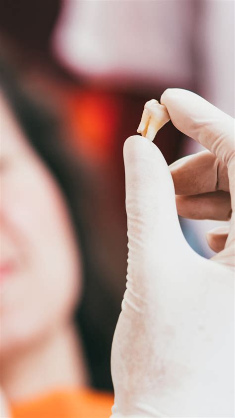 When Can I Eat Solid Food After A Tooth Extraction