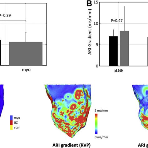 Activation Recovery Interval Ari Gradients A Mean Ari Gradient In