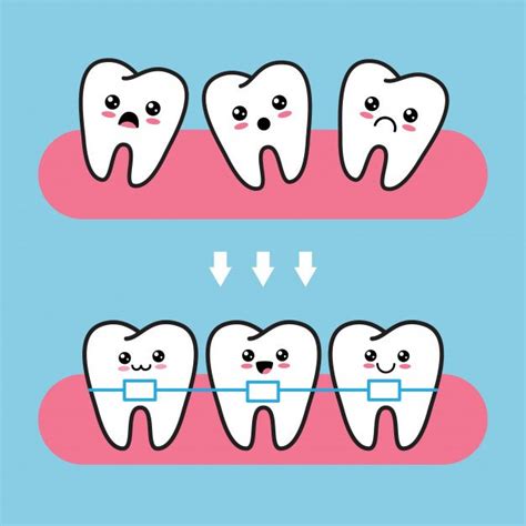 Шүдний аппарат зүүхээр төлөвлөсөн хүнд зөвлөх 8 зүйл Индранил Дентал Менежмент ХХК