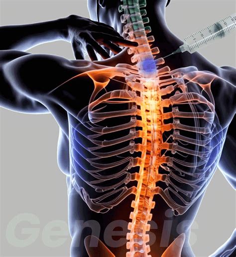 Medical Branch Block Cervical And Thoracic Genesis
