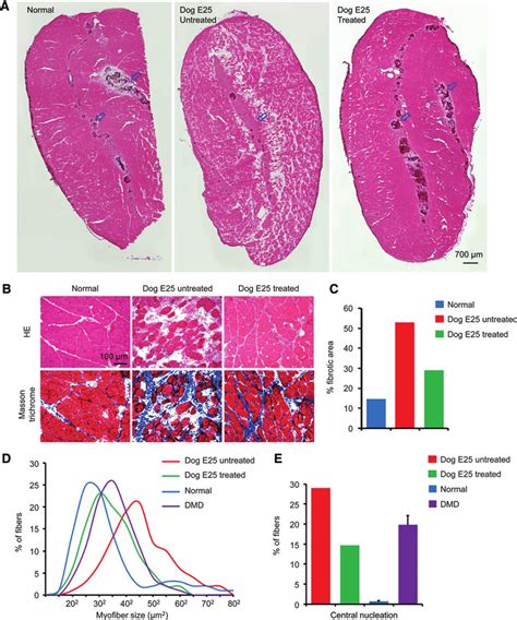 Dual Aav Dh2 R15 Mini Dystrophin Treatment Ameliorated Dystrophic