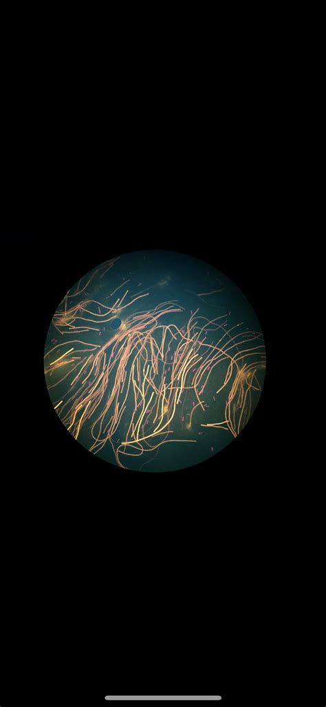 Algae Beads Lessons For High School Part 1 Algae Research Supply