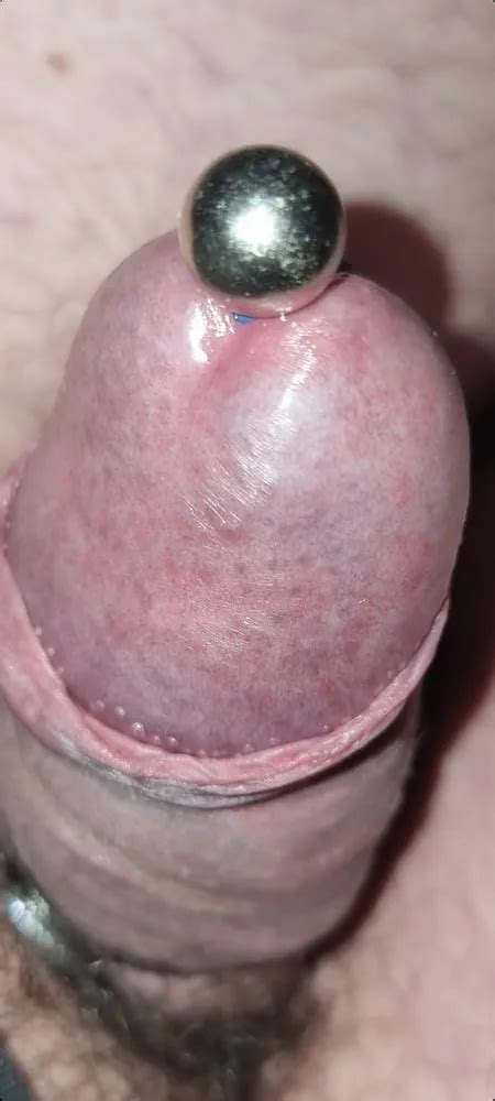 Cock Rings 20 Pics Xhamster
