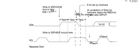 I C Master Mode Repeated Start Condition Timing