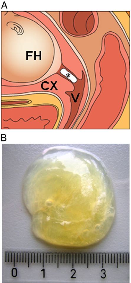 Cervical Mucus Plug Semantic Scholar