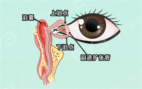 兰州爱尔眼科医院丨总是莫名流泪，竟是泪道在 “求救” 中国镇江金山网 国家一类新闻网站
