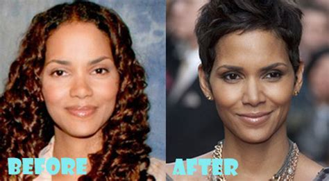 Halle Berry Plastic Surgery Before And After Lovely Surgery