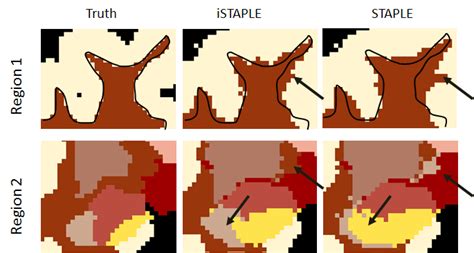 Results On Whole Brain Segmentation On One Ibsr Data Set A From Left Download Scientific