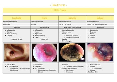 Otitis Externa Alejandro Chávez Camacho Udocz