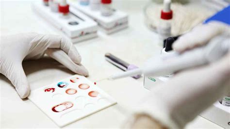 Drug Screening Methods Of Drug Testing Da Ta Biotech