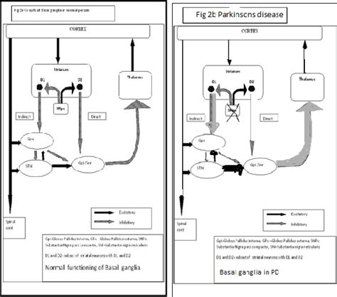 Figure 1 From Computational Analysis Of Microelectrode Recording Of Sub Thalamic Nucleus Neural