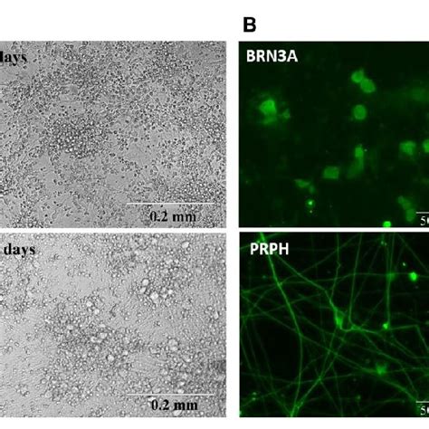 Microscopic Characterization Of Cryopreserved Ipsc Sensory Neuron Download Scientific Diagram