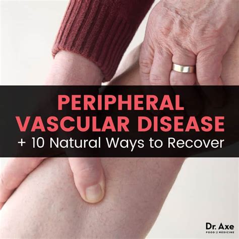 Peripheral Venous Disorders
