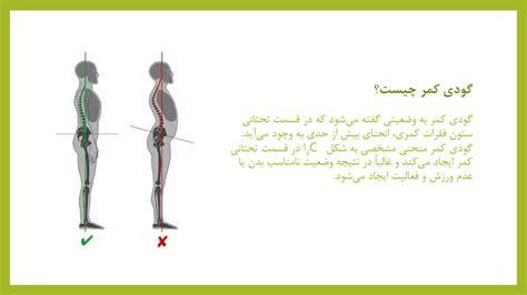 دانلود فایل پاورپوینت گودی کمر و حرکات اصلاحی آن برای ارائه ورزش فاپول