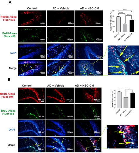 If Imaging Of Double Labeled Brdu Nestin And Brdu Neun Cells In Dentate Download Scientific