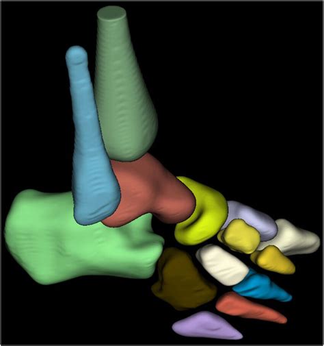 Volumetric Segmentation Of The Foot And Ankle Bones Download Scientific Diagram