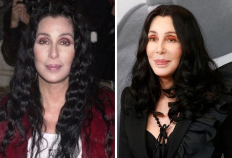 Cher Plastic Surgery How The Goddess Of Pop Changed