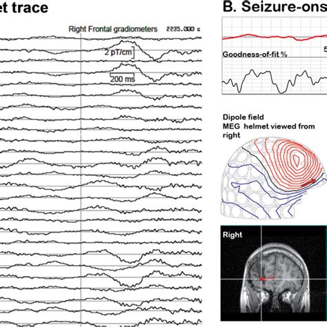 Hybrid Megmri System At Aalto University A Photograph From Inside Download Scientific