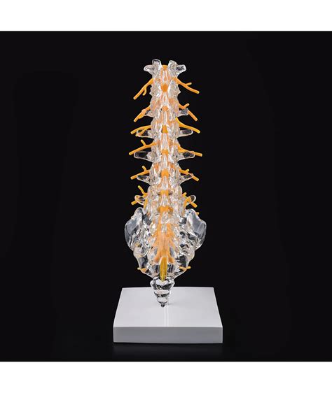 Ultrassist Modelo De Columna Lumbar Humana Con Sacro Nervios Espinales Y Hernia De Disco Incluye