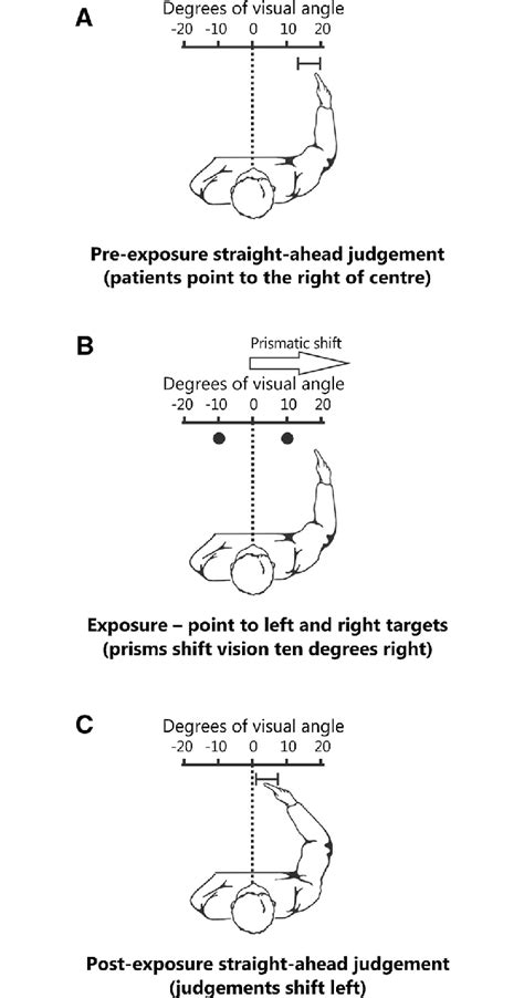 Schematic Representation Of Prism Adaptation In Neglect A Patients Download Scientific Diagram