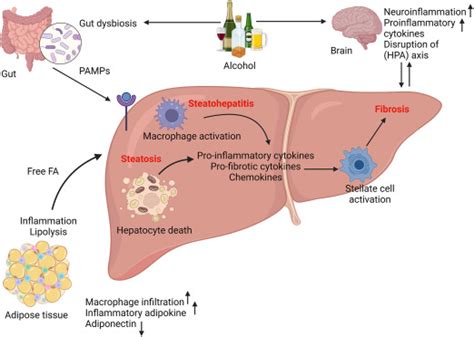 Pathogenesis Of Alcohol Associated Liver Disease Clinics In Liver Disease