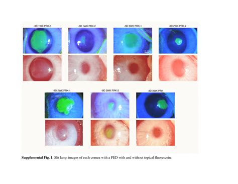 Pdf Cell Biology Of Spontaneous Persistent Epithelial Defects After