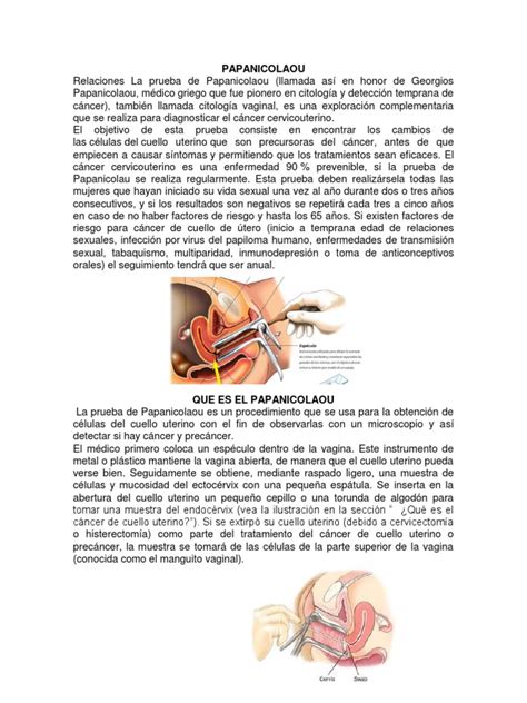 Prueba De Papanicolaou Detección De Cáncer Cervical Pdf Medicina