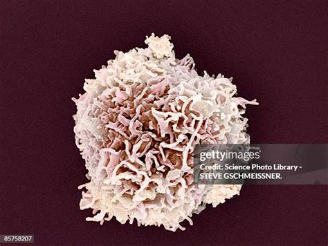 Immune Electron Microscopy Photos And Premium High Res Pictures Getty
