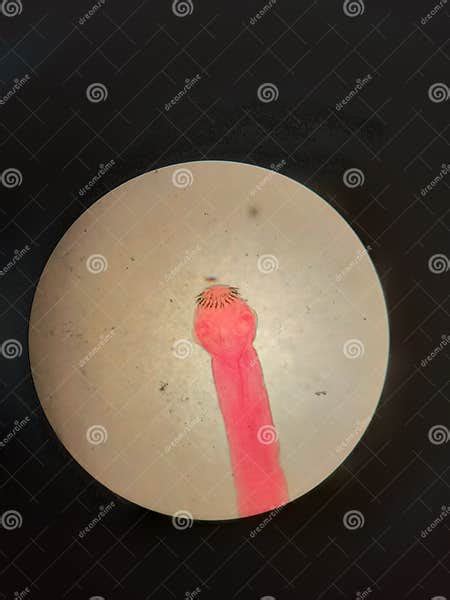 Microscopic View Of Tapeworm Stock Image Image Of Head Pink 233119561