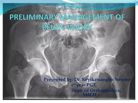 Preliminary Management Of Pelvic Injury Ppt
