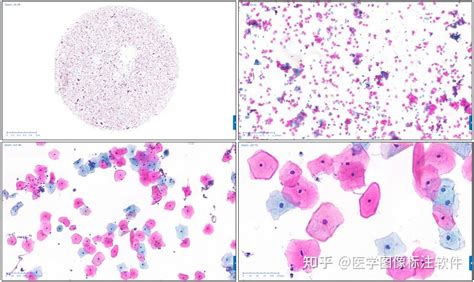 助力医学临床ai — Misat医学图像分割与标注软件套装 知乎